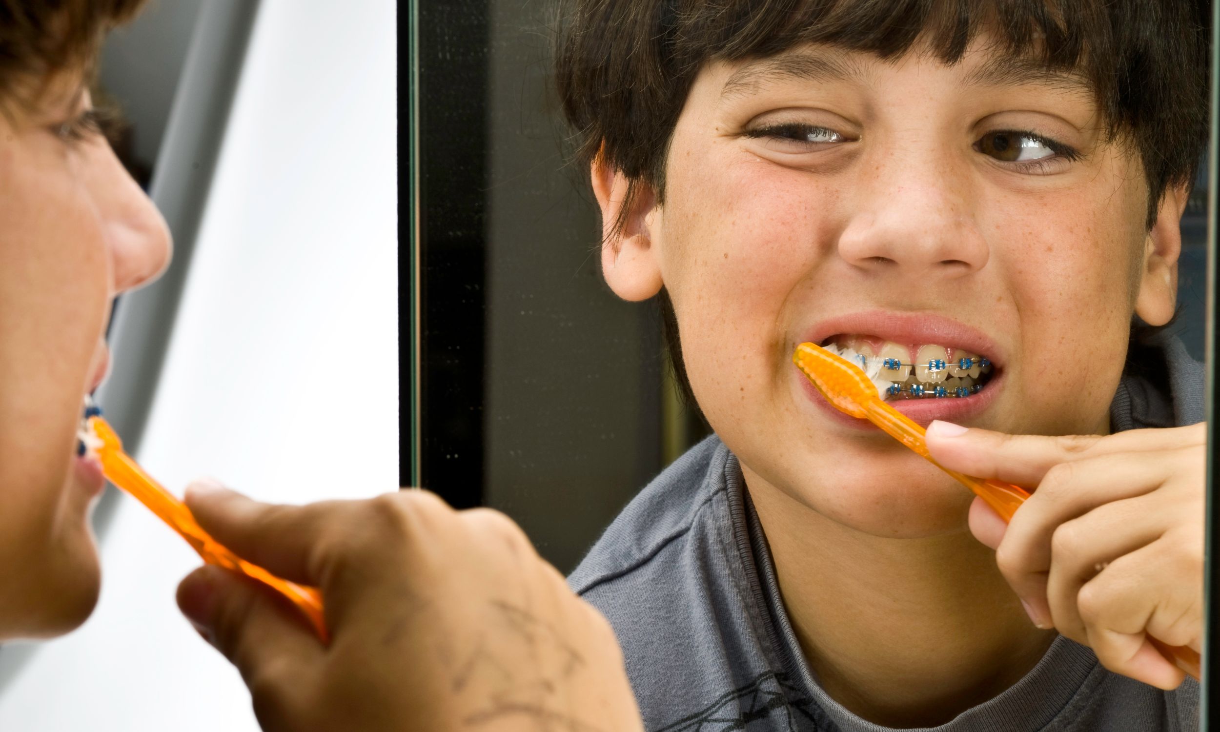 Braces Post Op Instructions: Pain Relief, Diet & Oral Care